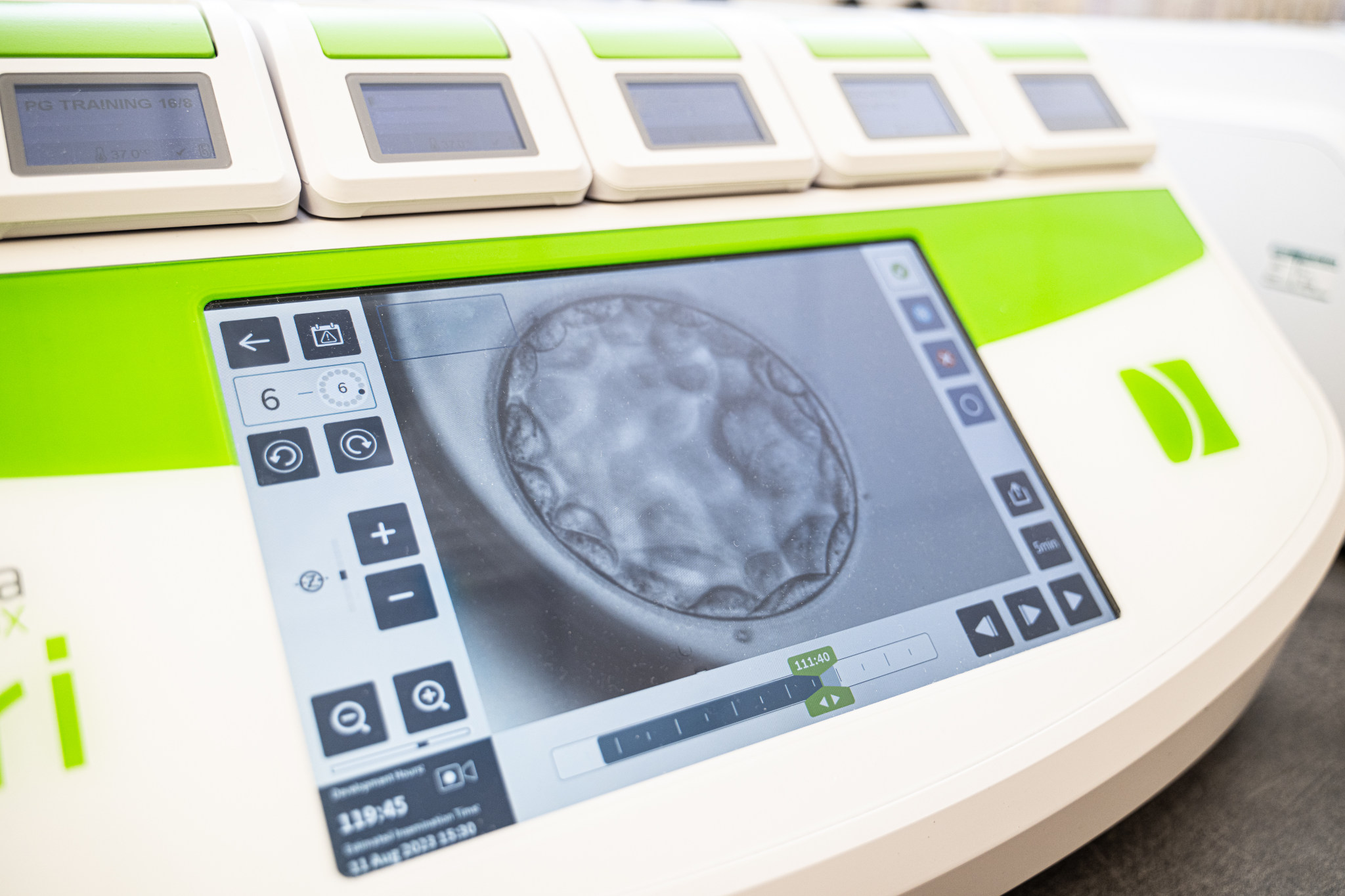 Embryo quality and grading – does it affect success? - Leicester ...