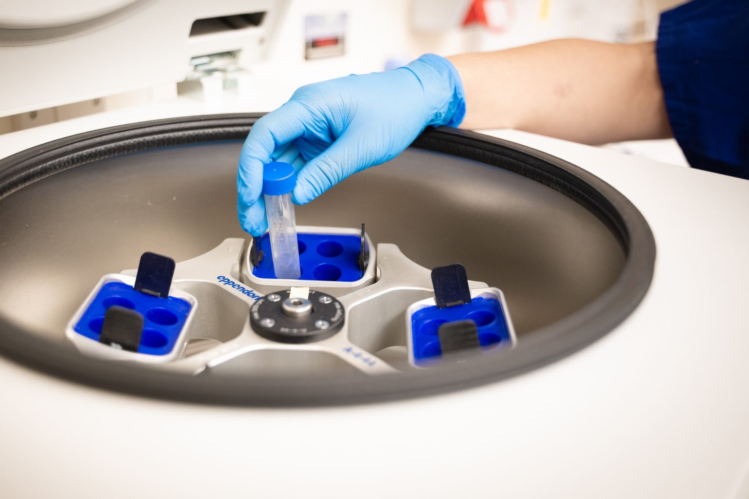 Fertility Testing - Leicester Fertility Centre